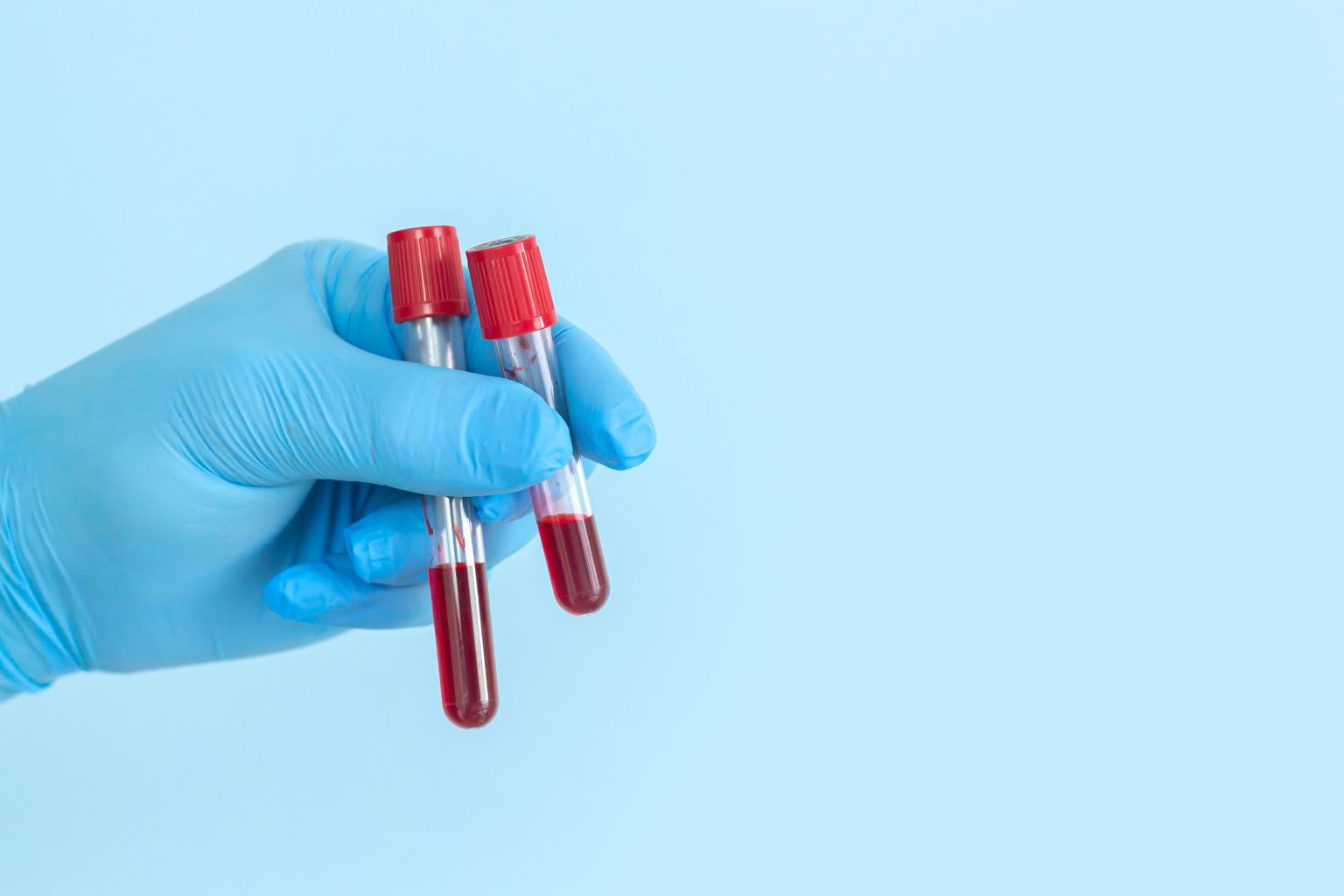 Public Health Laboratory – Department of Public Health